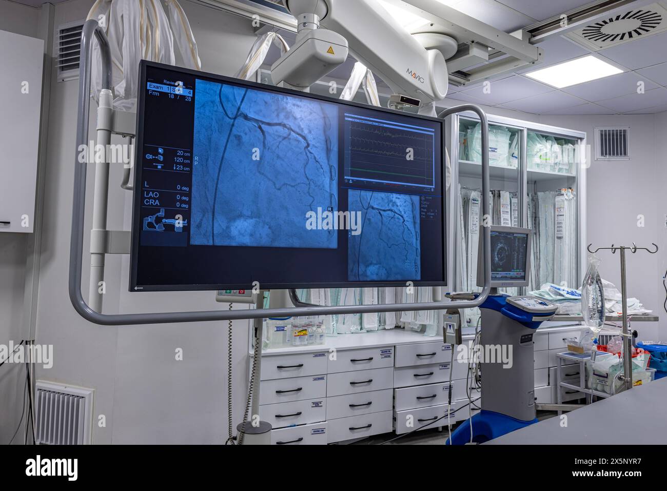 Denizli Turkey 29 February 2024; Heart operating room. Complex heart ...