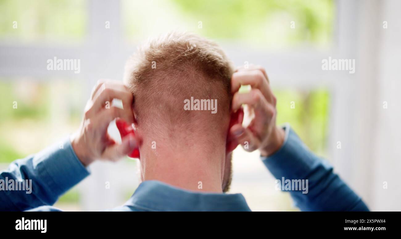 Itching Dry Head Scalp And Long Hair With Dandruff Stock Photo - Alamy