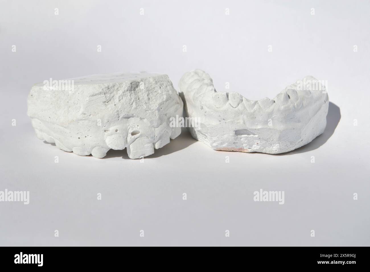 Dental casting gypsum model plaster cast stomatologic human jaws ...