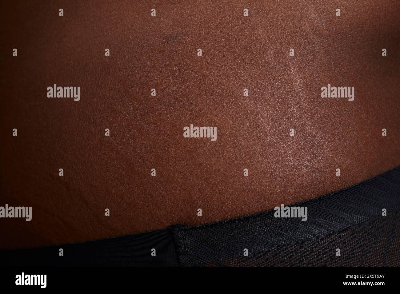 Full frame view of human skin with stretch marks Stock Photo - Alamy
