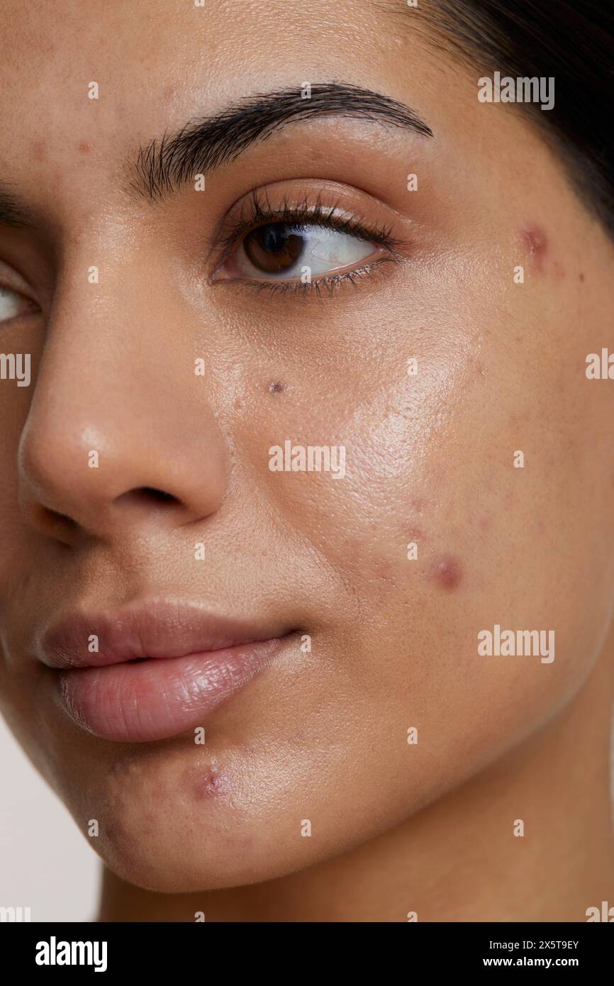 Acne studio hi-res stock photography and images - Alamy