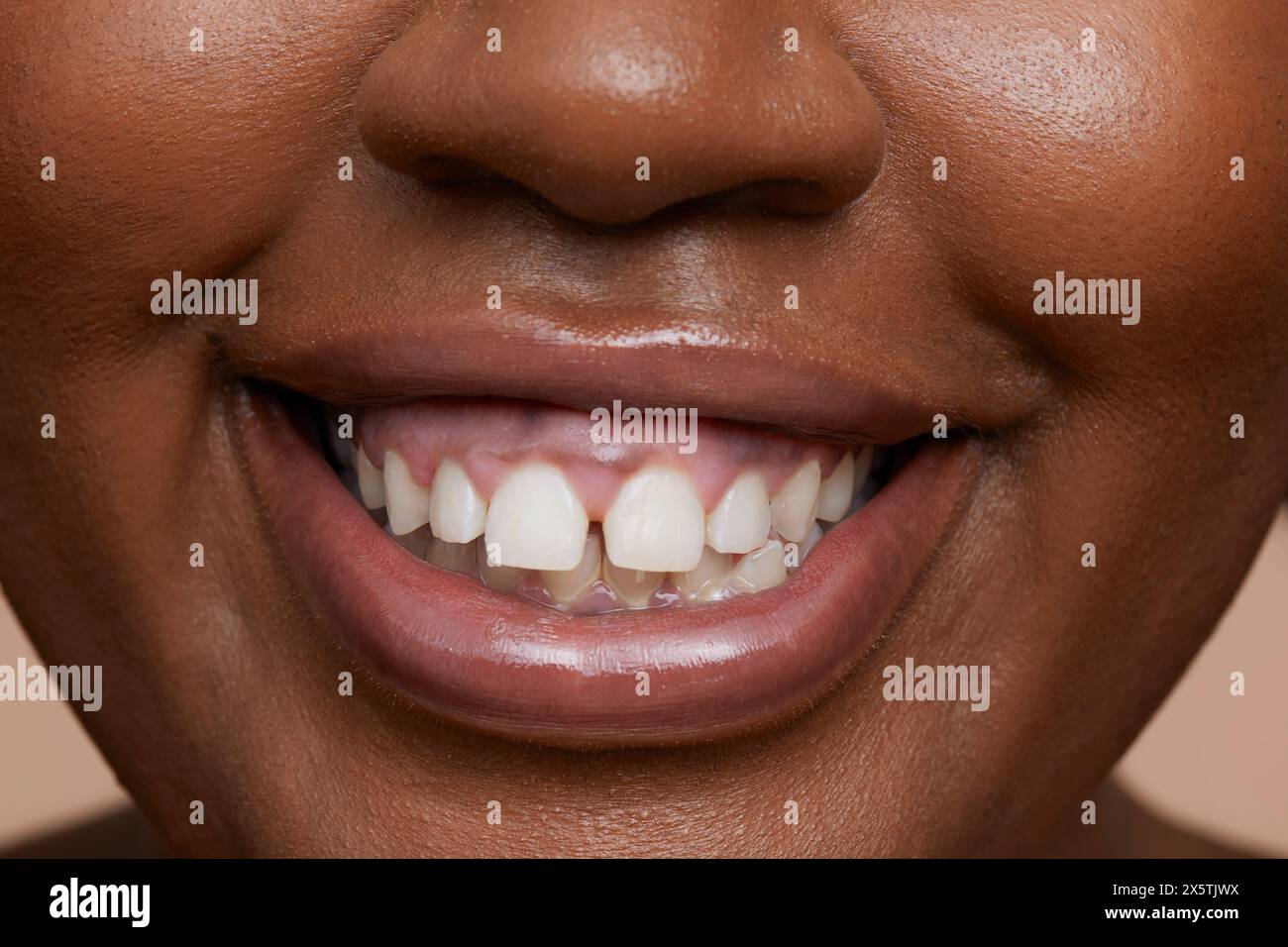 Toothy smile teeth hi-res stock photography and images - Alamy