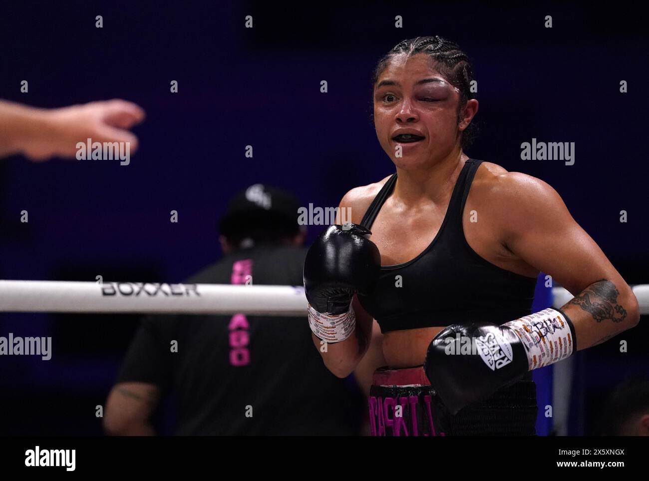 Jessica McCaskill with an eye injury that brings an end to the IBA and ...