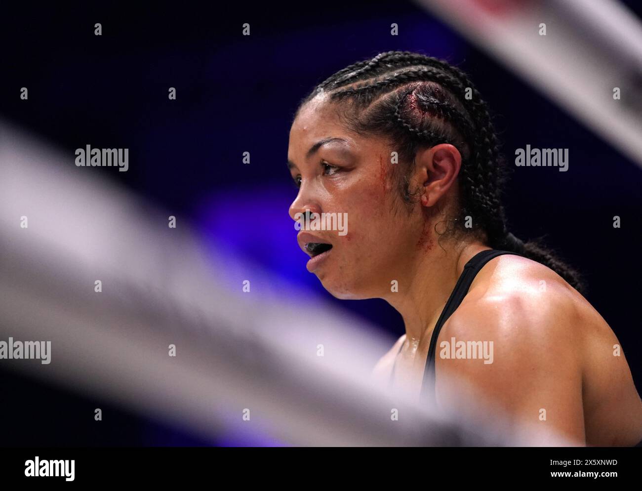 Jessica McCaskill with an eye injury that brings an end to the IBA and ...