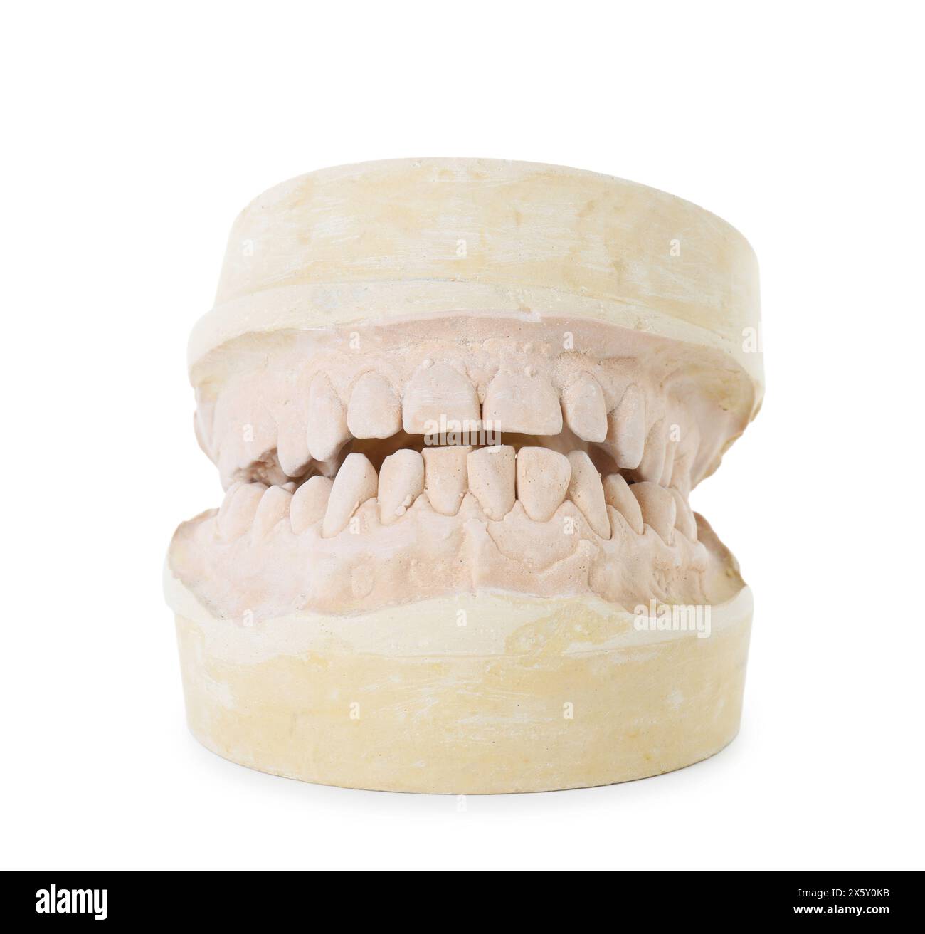 Dental model with jaws isolated on white. Cast of teeth Stock Photo - Alamy