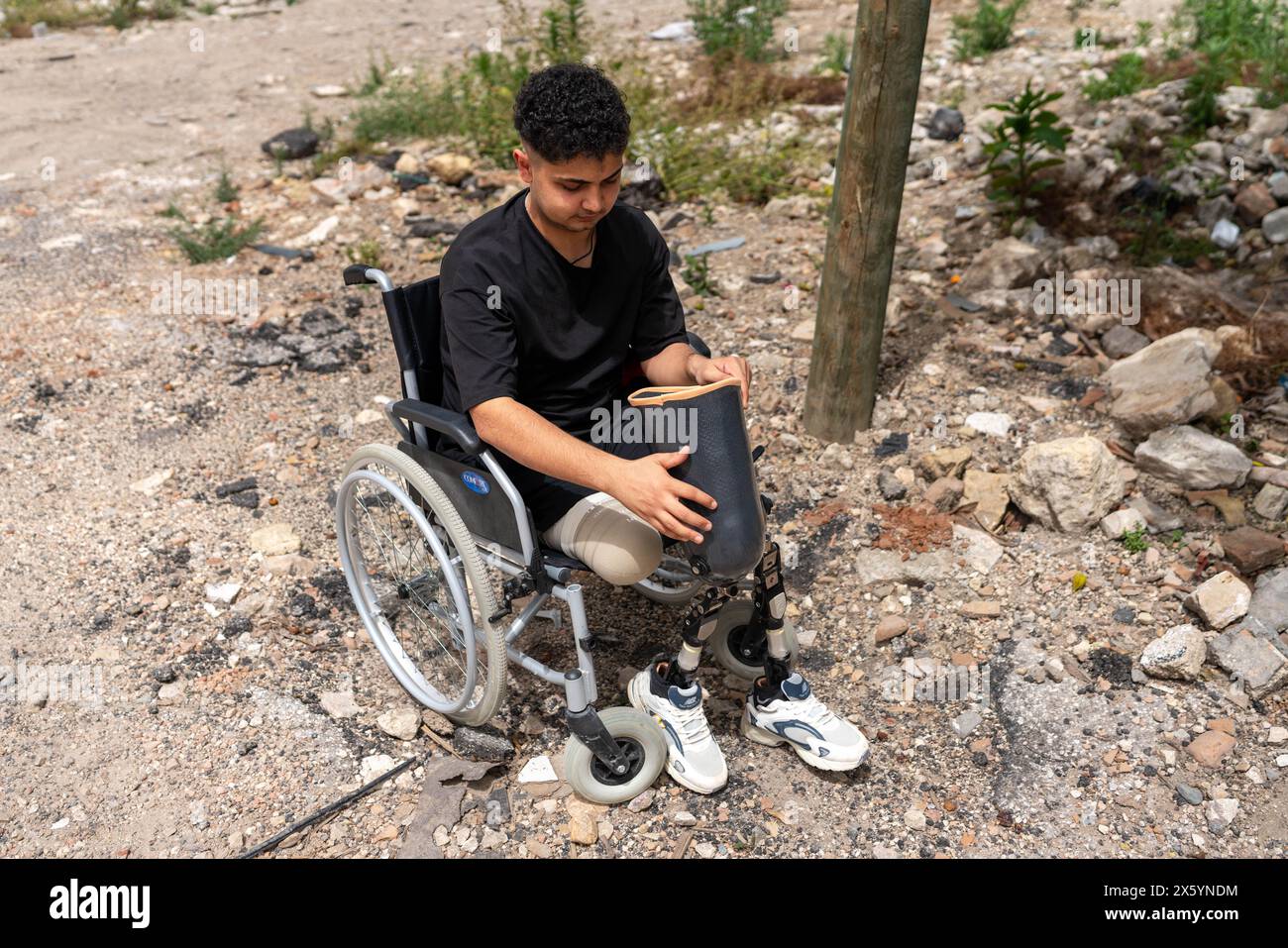 Onur takes off his prostheses to ventilate his feet during the trip ...