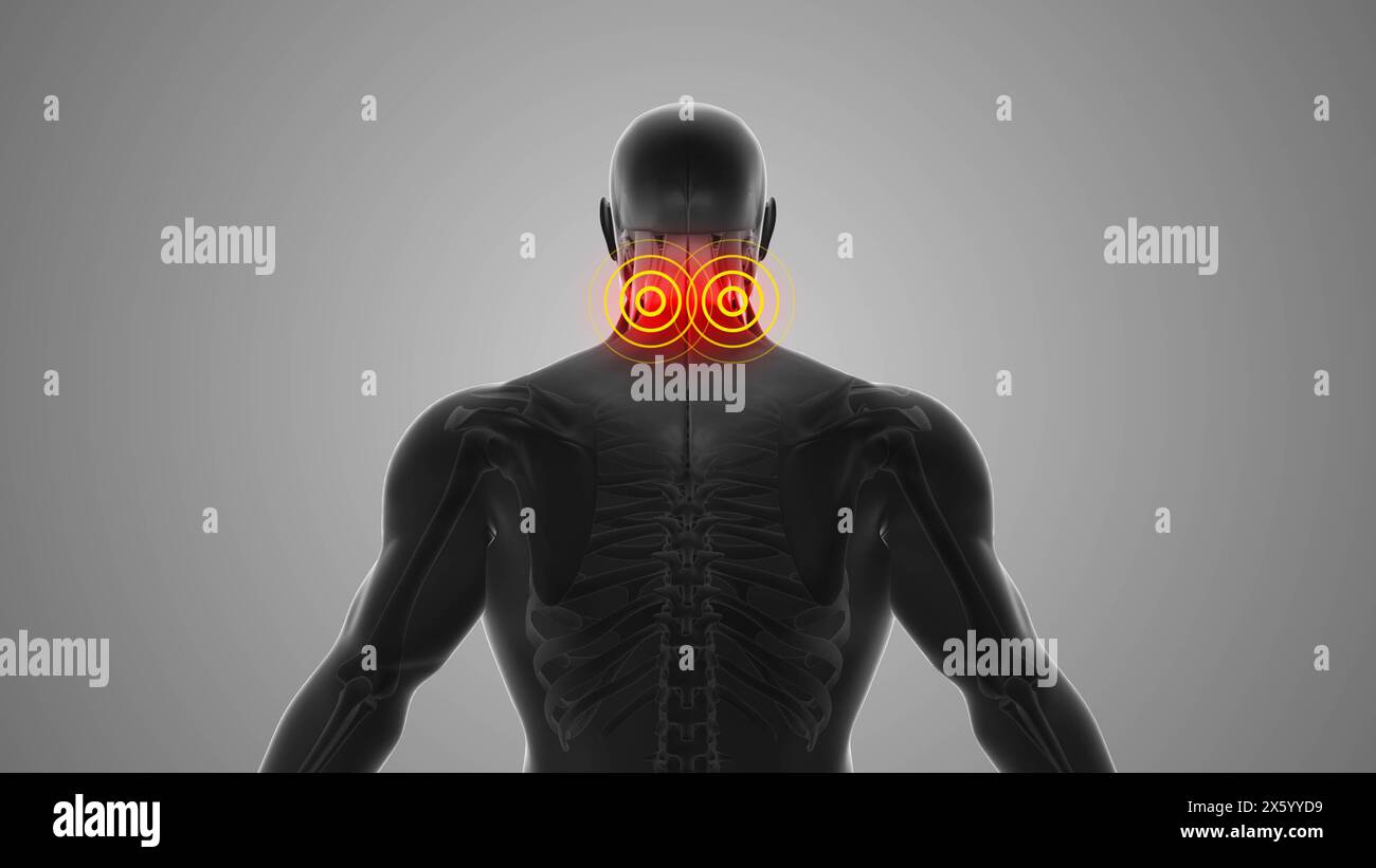 Neck discomfort that trigger pain Stock Photo - Alamy
