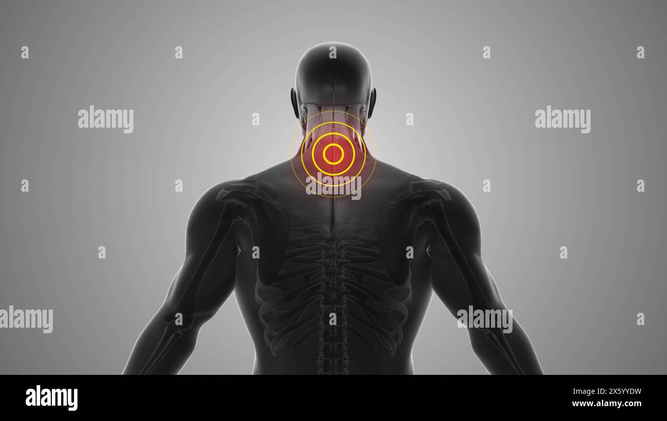 Lower neck discomfort that trigger pain Stock Photo - Alamy