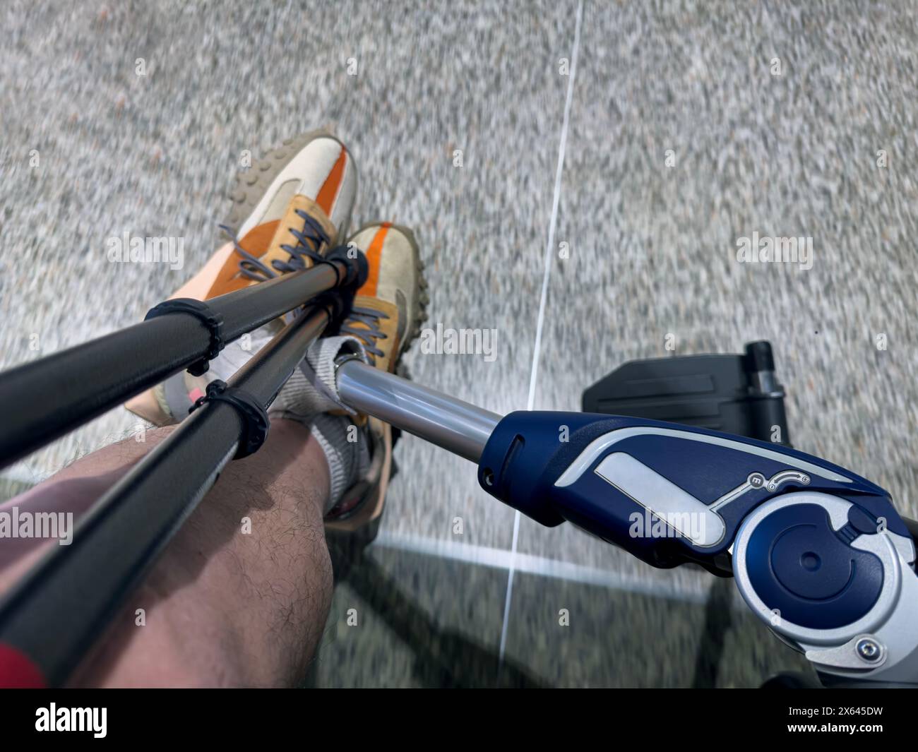 The leg of a disabled person crossed Stock Photo - Alamy