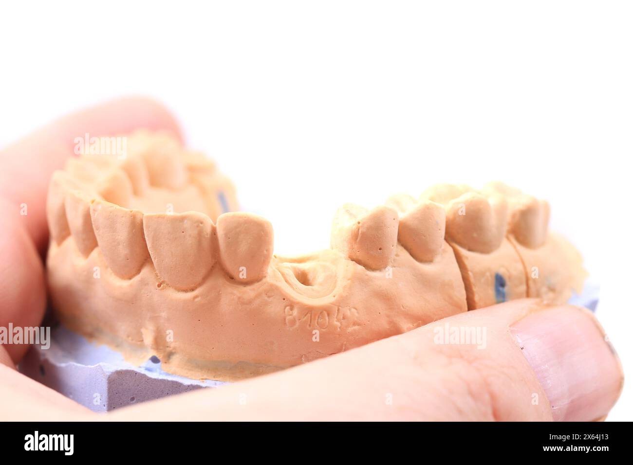 model of tooth prothesis isolated on white background Stock Photo - Alamy