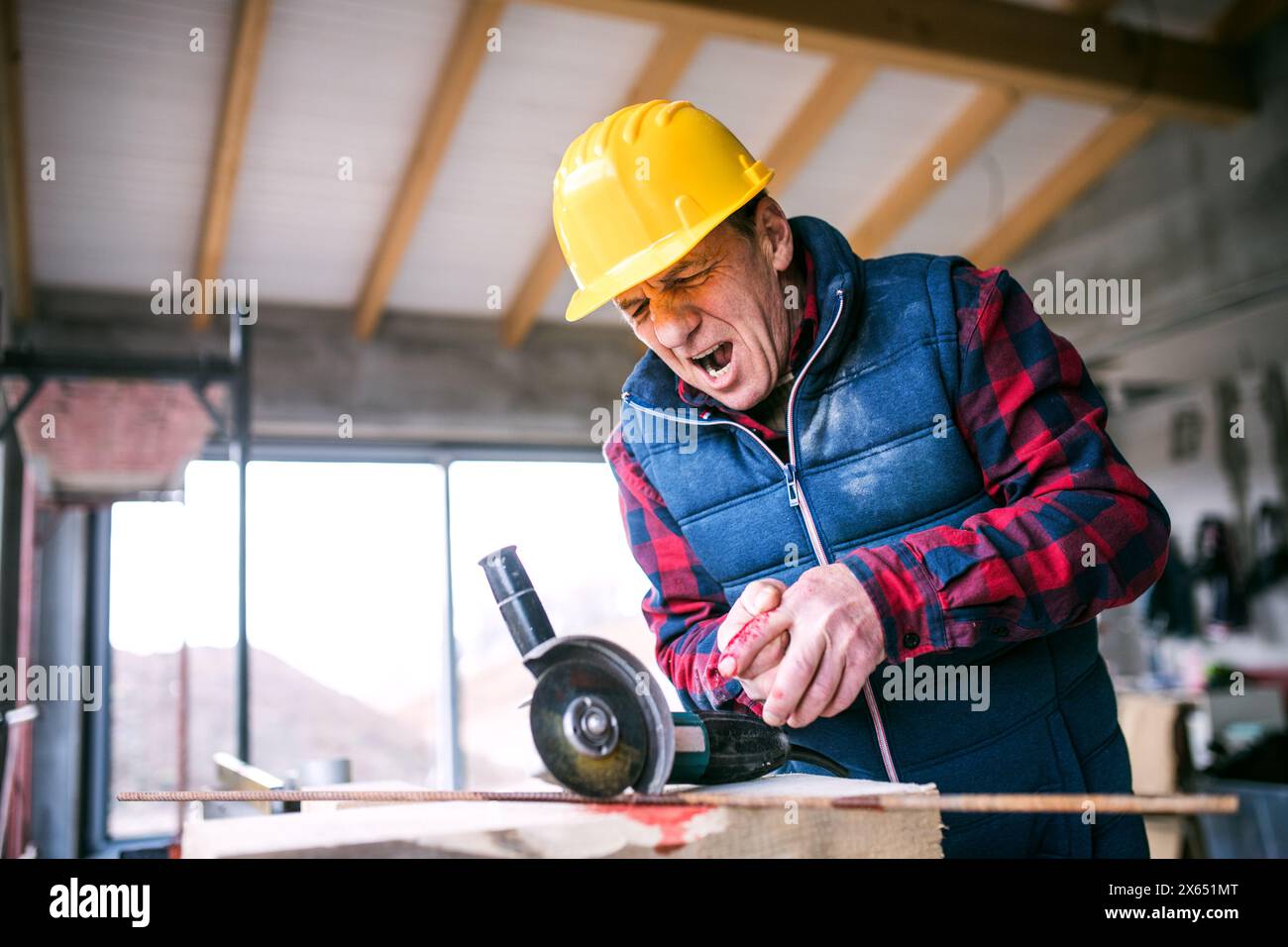 Sawing into finger with circular saw. Injured worker with wound hand ...
