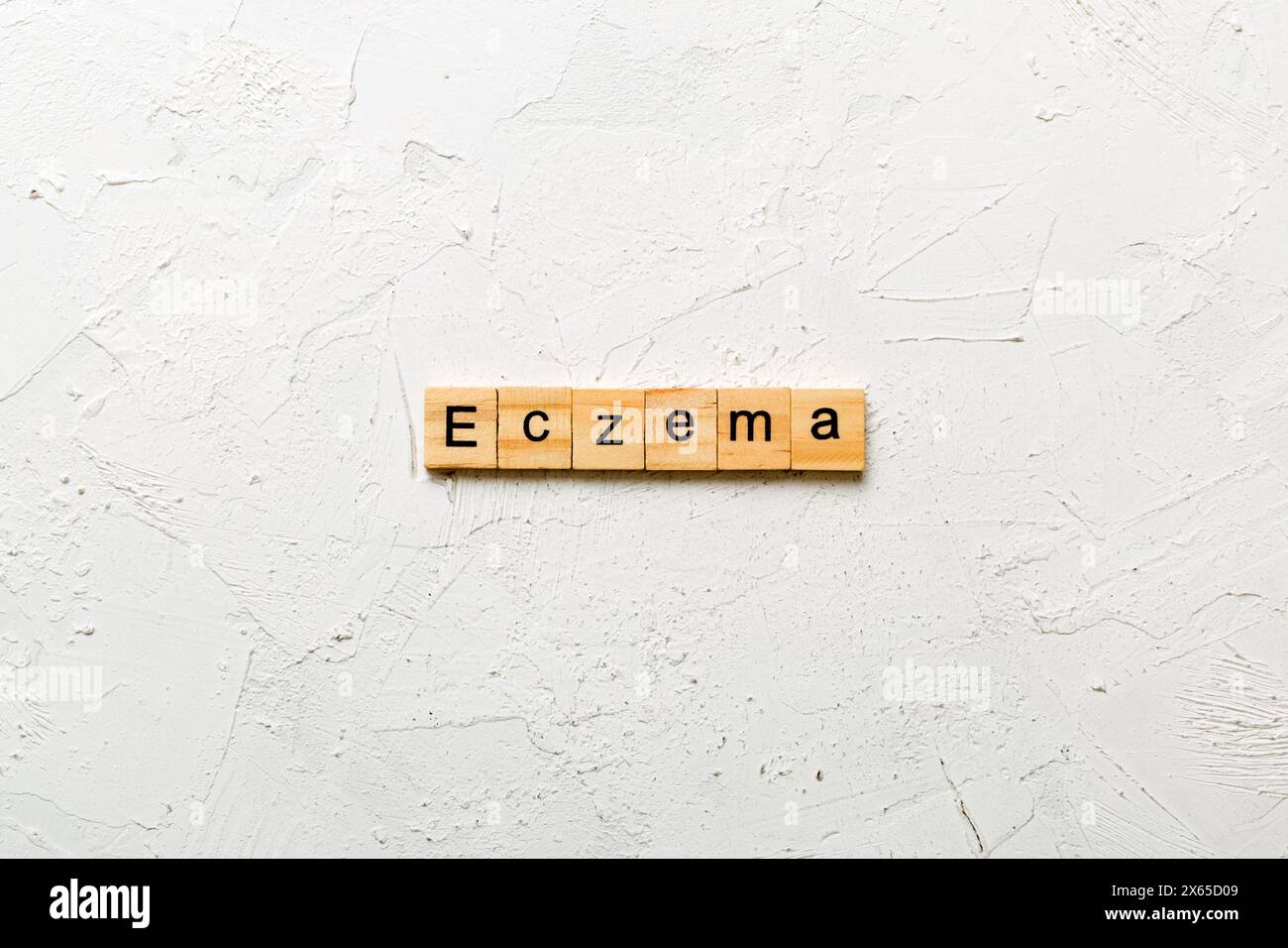 eczema word written on wood block. eczema text on table, concept Stock ...