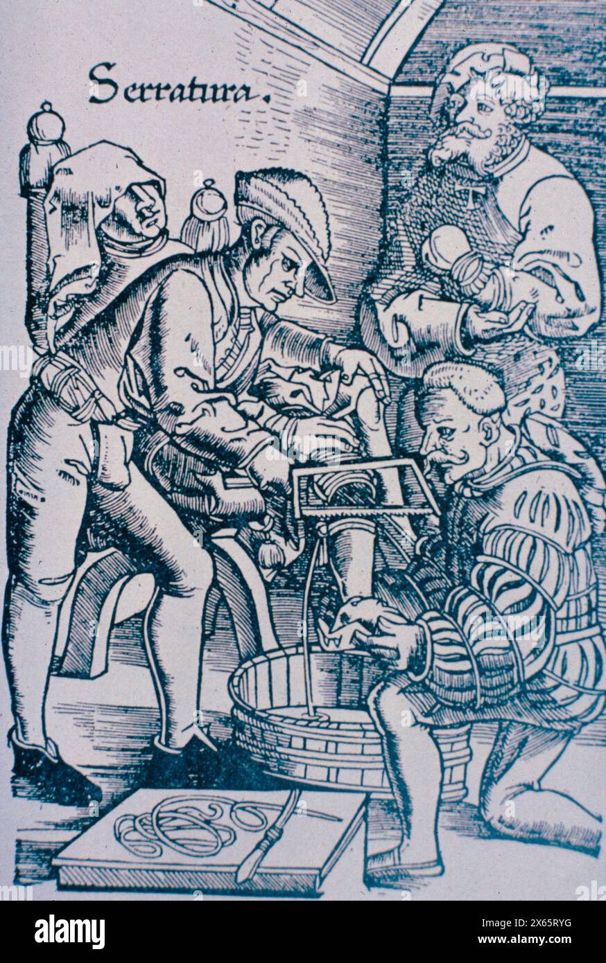 Drawing of a leg amputation in the 16th century Stock Photo - Alamy