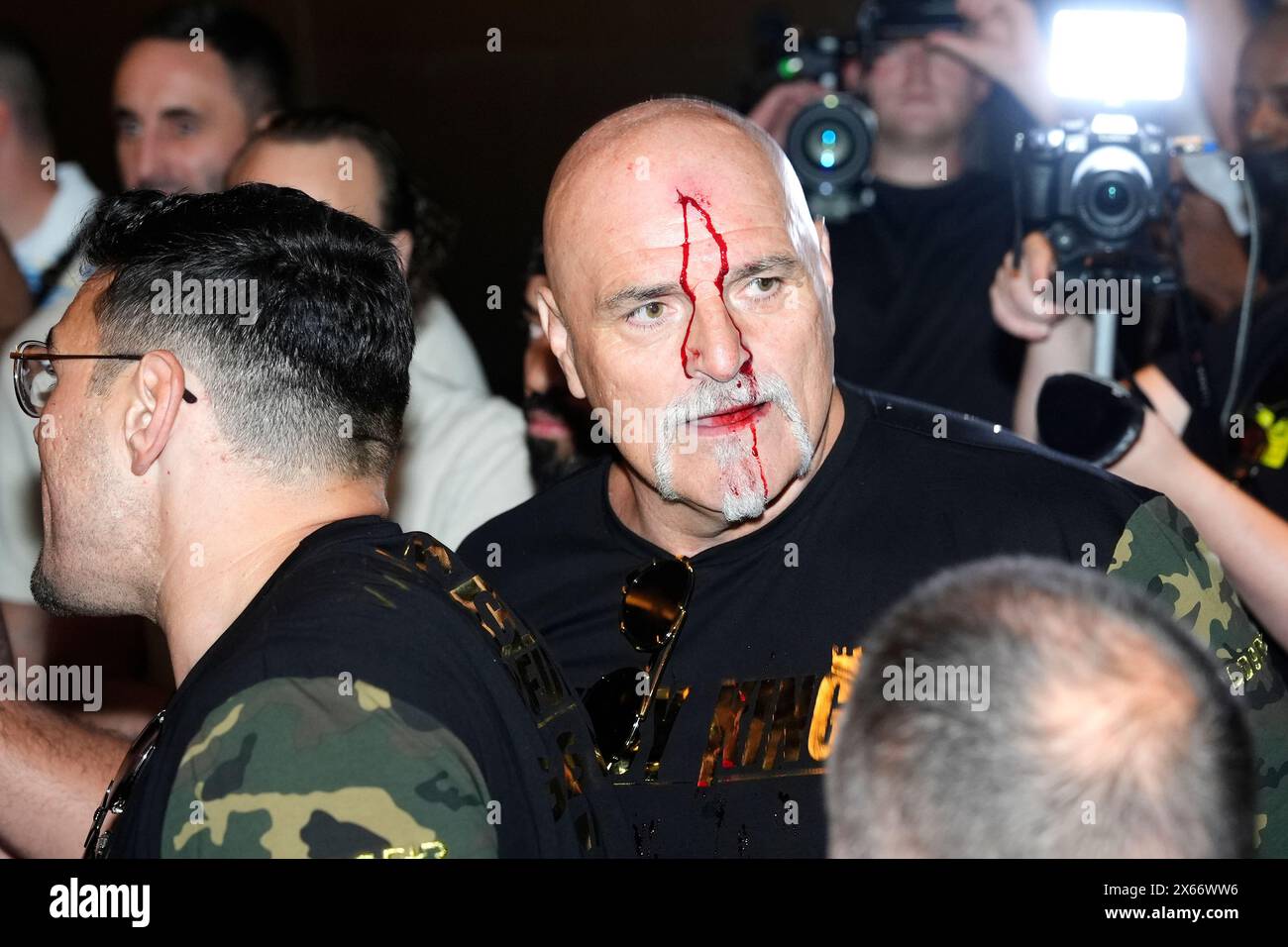 **EDITOR NOTE: Blood shown** John Fury, father of boxer Tyson Fury ...