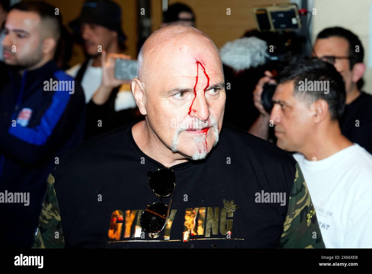 **EDITOR NOTE: Blood shown** John Fury, father of boxer Tyson Fury ...