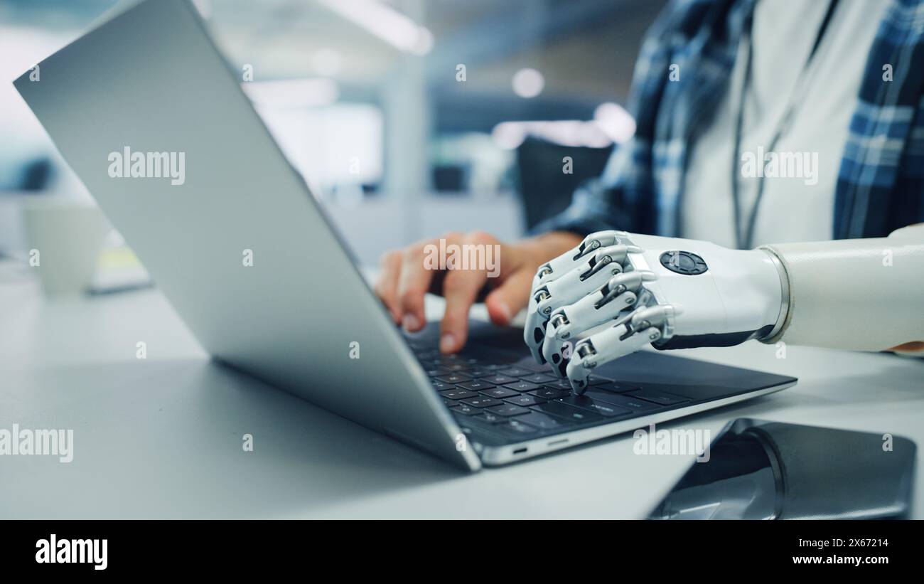 Close-up on Hands: Programmer With Disability Using Prosthetic Arm to Work on Laptop Computer ...