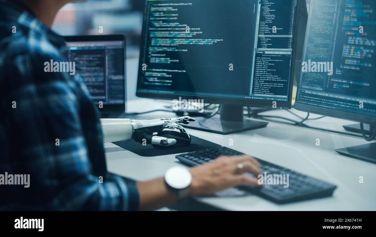 Woman prosthetic hand work on hi-res stock photography and images - Alamy