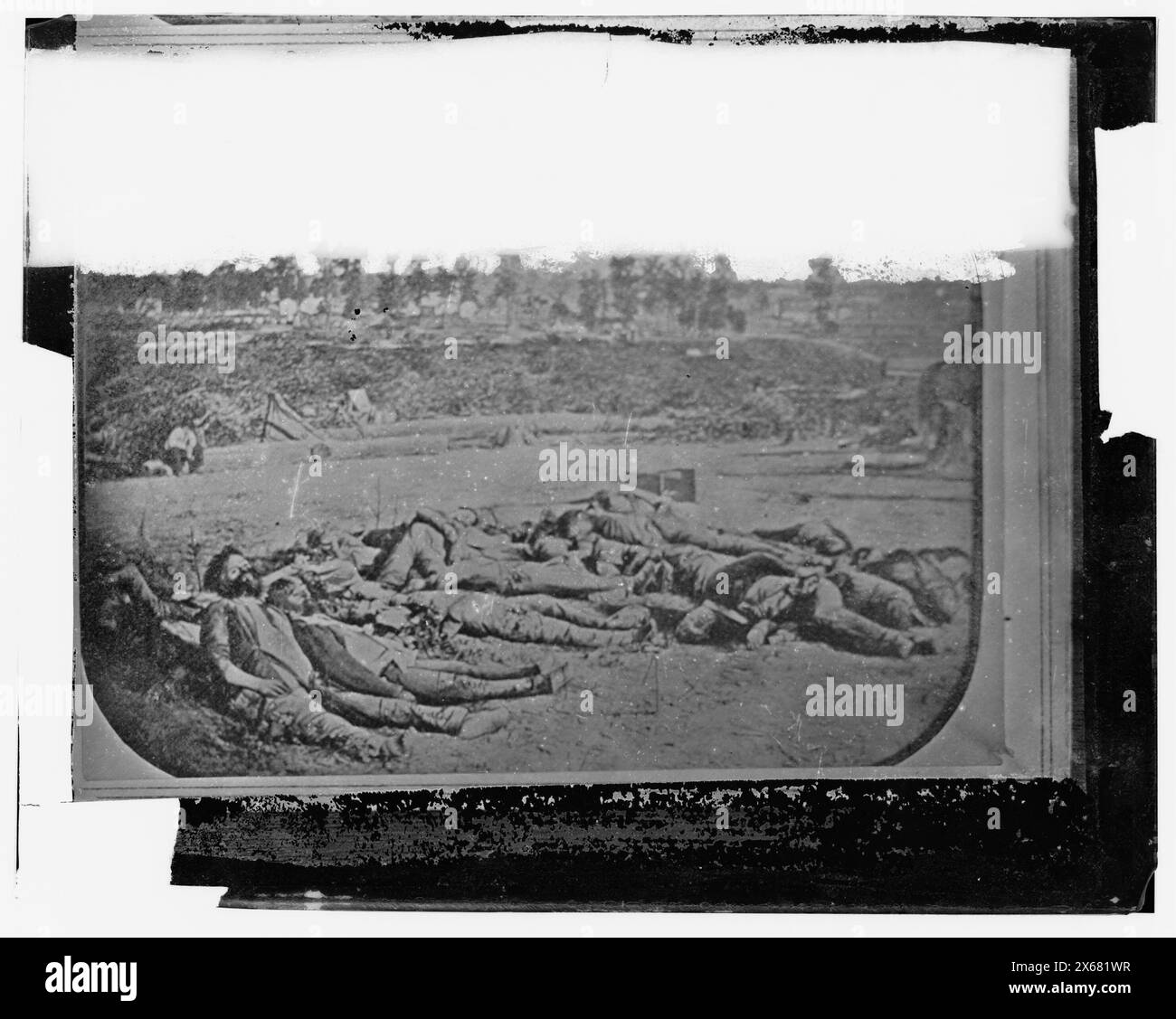Corinth, Mississippi. Confederate dead in front of Battery Robinette ...