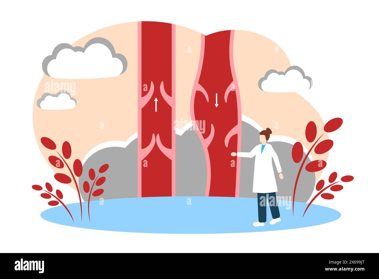 Chronic vein Stock Vector Images - Alamy