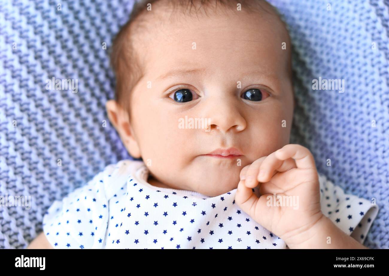 Conjunctivitis. Little baby with red eyes in bed, closeup Stock Photo ...