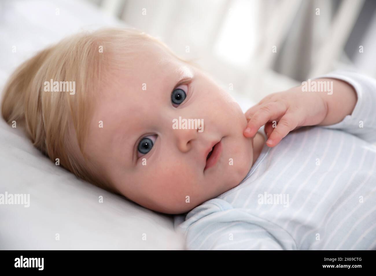Conjunctivitis. Little baby with red eyes in bed, closeup Stock Photo ...