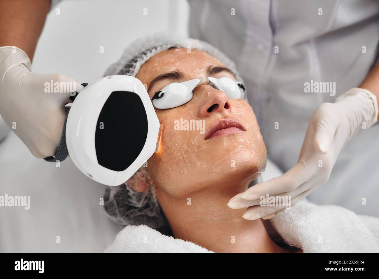 A woman receives IPL therapy in a beauty salon Stock Photo - Alamy