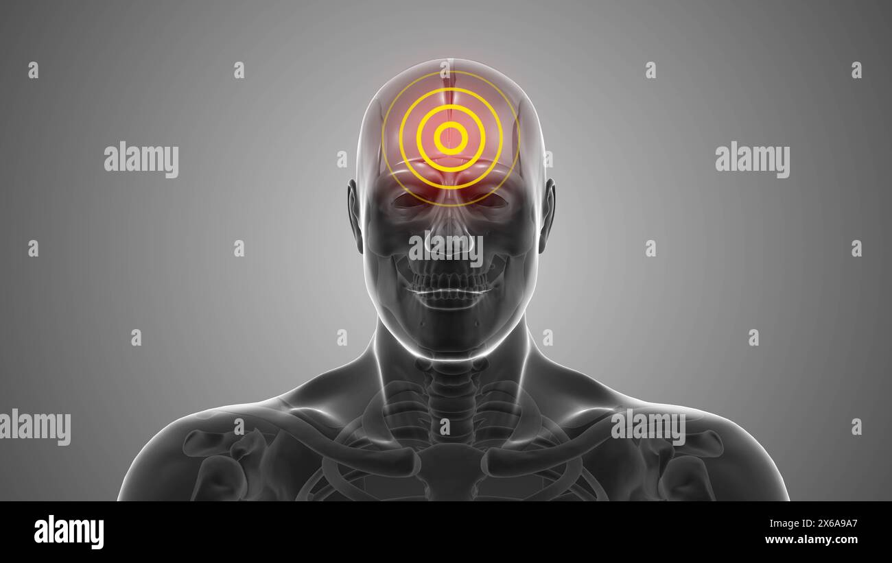 Forehead discomfort that trigger pain Stock Photo - Alamy