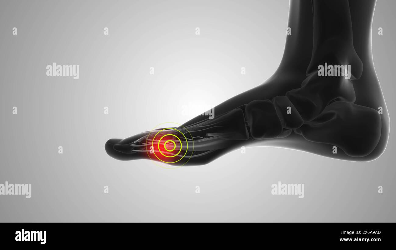 Mtp joint hi-res stock photography and images - Alamy