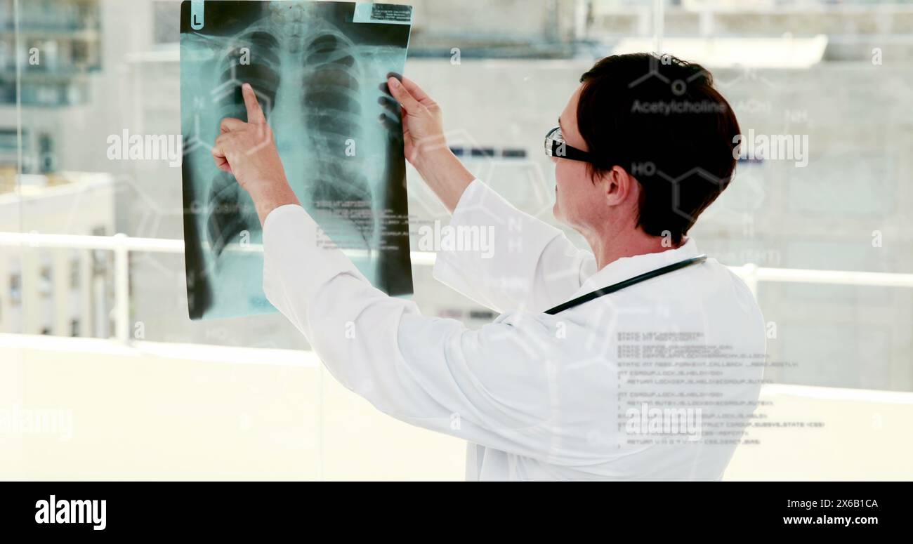 Image of scientific data processing over caucasian female doctor with x ...