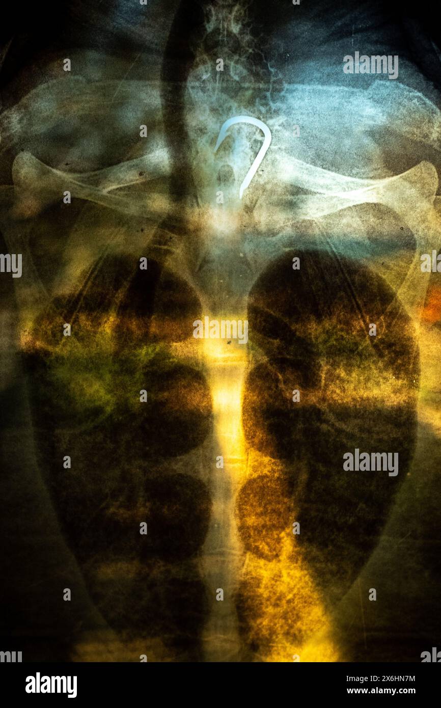 X-ray of a hamstring inserted into a turtle at the Archelon Sea Turtle ...
