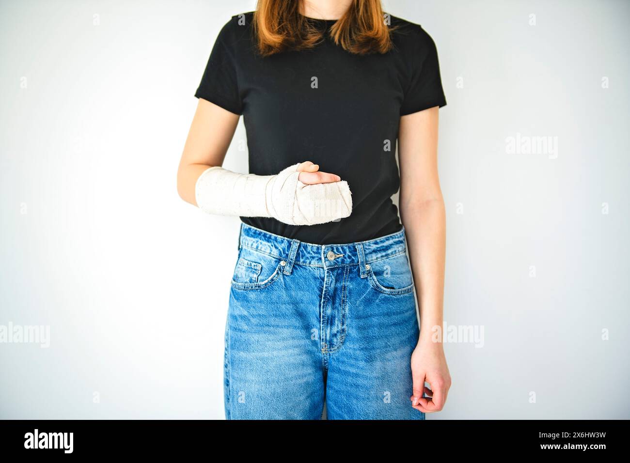 injury hand and arm isolated on white background Stock Photo - Alamy