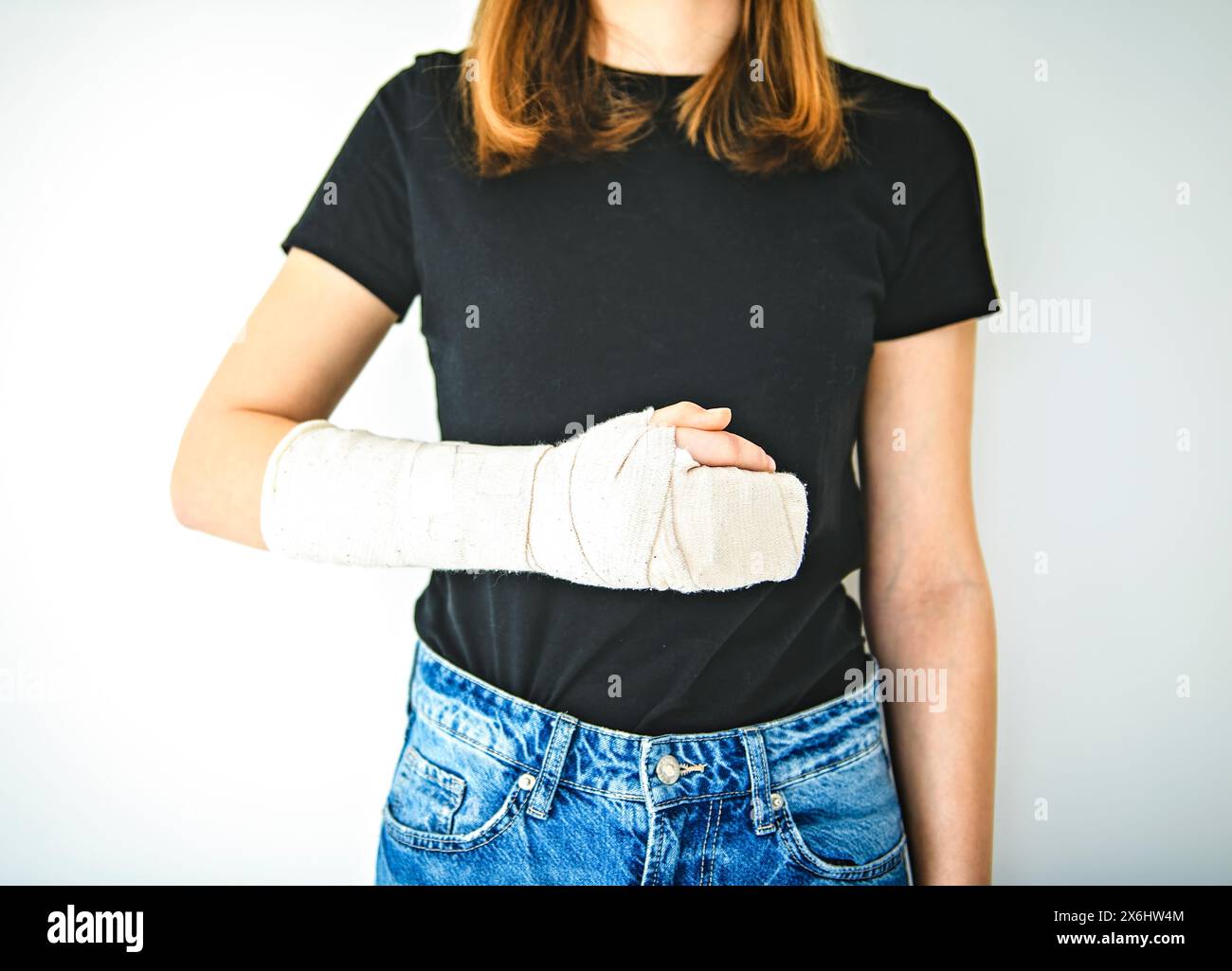 injury hand and arm isolated on white background Stock Photo - Alamy