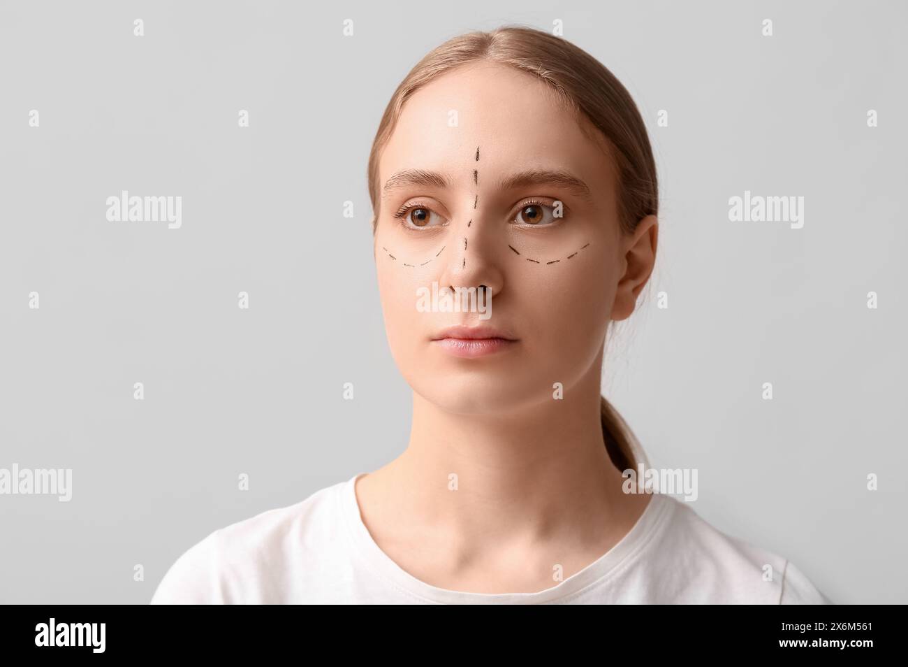 Young woman with marks on her face against grey background ...