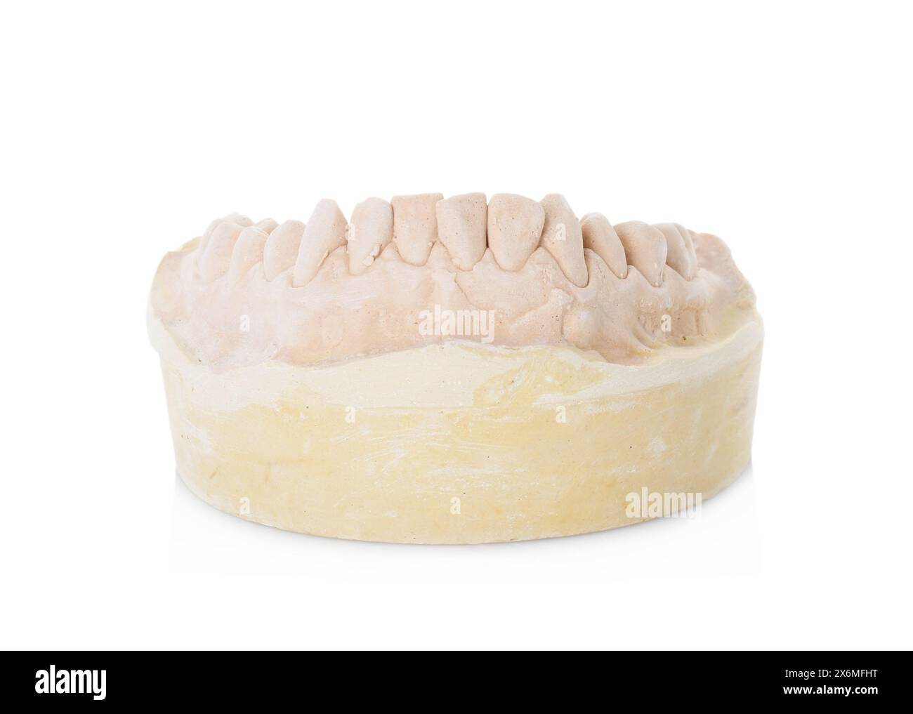 Dental model with jaw isolated on white. Cast of teeth Stock Photo - Alamy