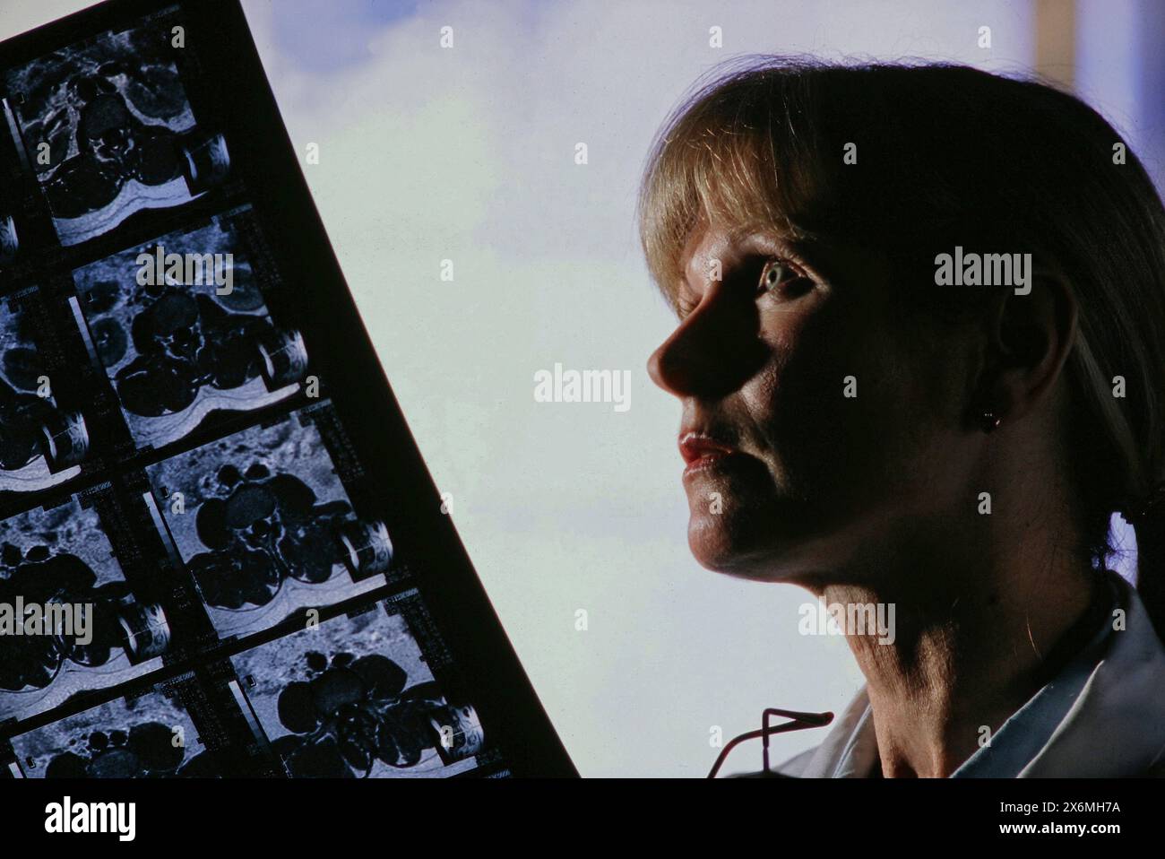 A medical professional is closely examining multiple MRI scans ...