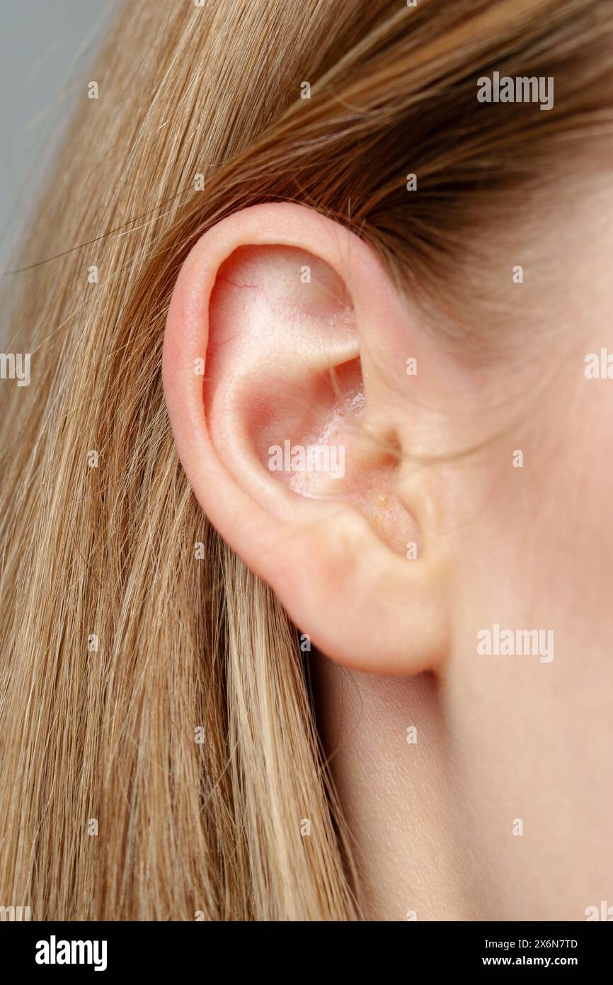 Womans ear detail hi-res stock photography and images - Alamy