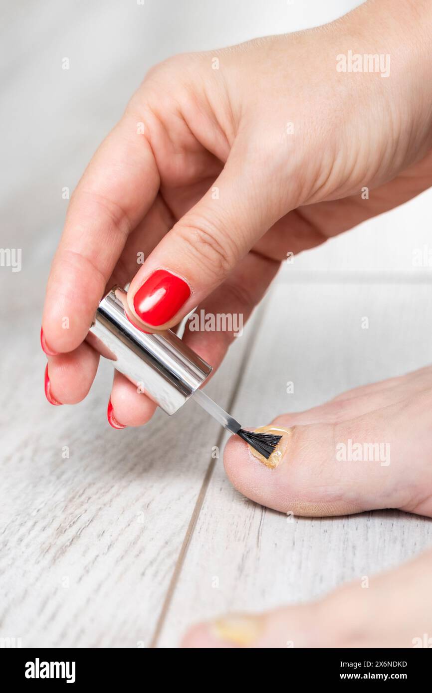 woman applying strengthening varnish to her big toe nail. applying ...