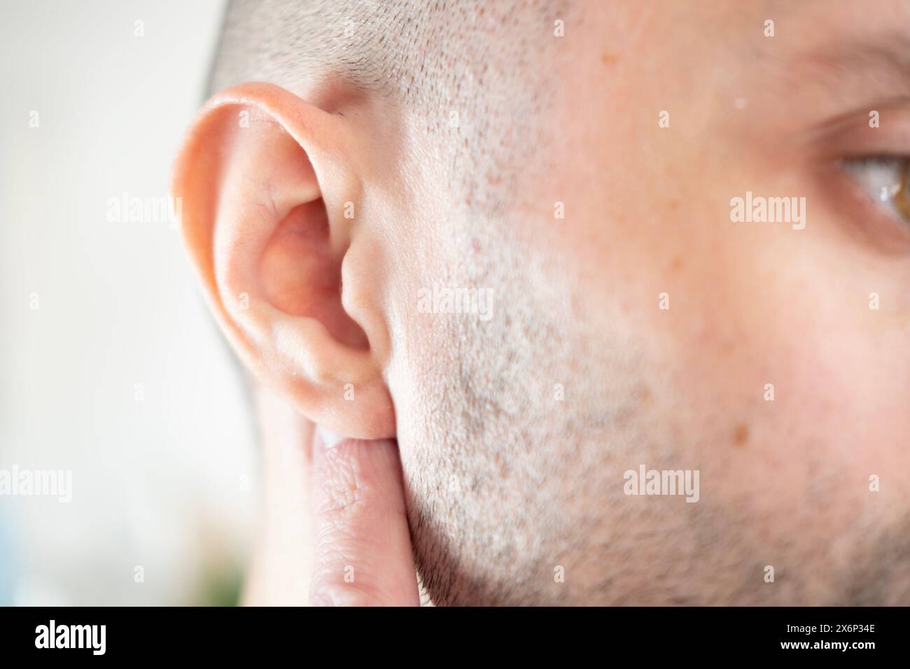 caucasian young man holding painful ear close up, hearing loss, Ear ...