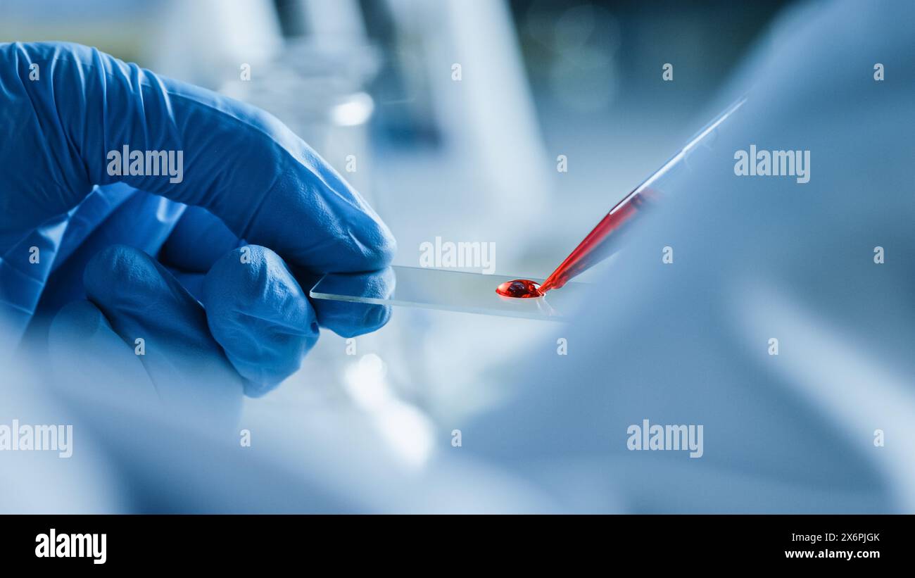 Close Up Macro Shot of a Scientist in Gloves Using Micro Pipette and ...