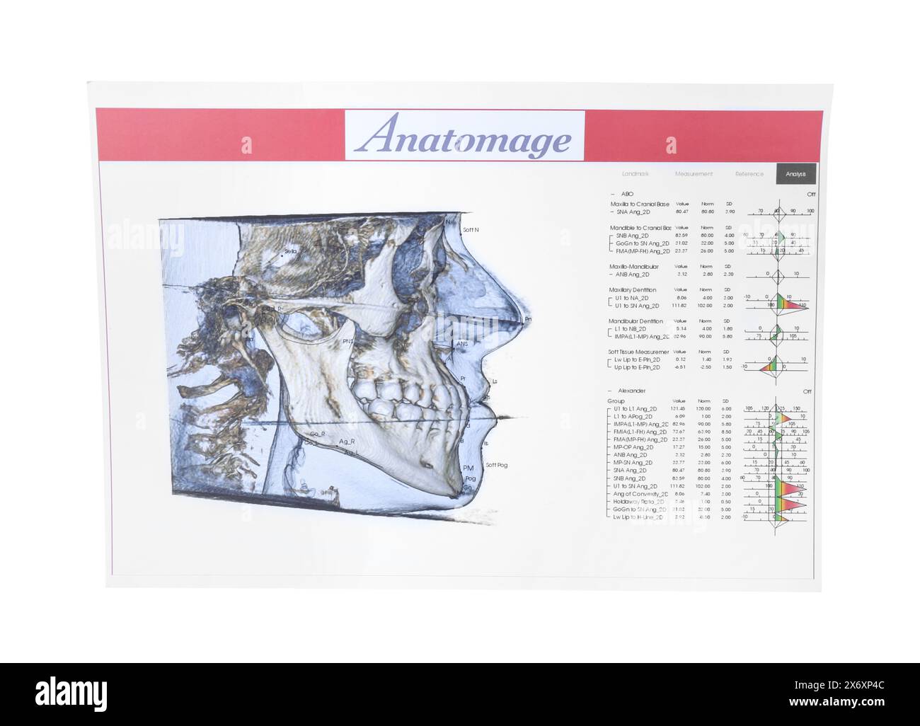 Visualization of human maxillofacial section for dental analysis ...