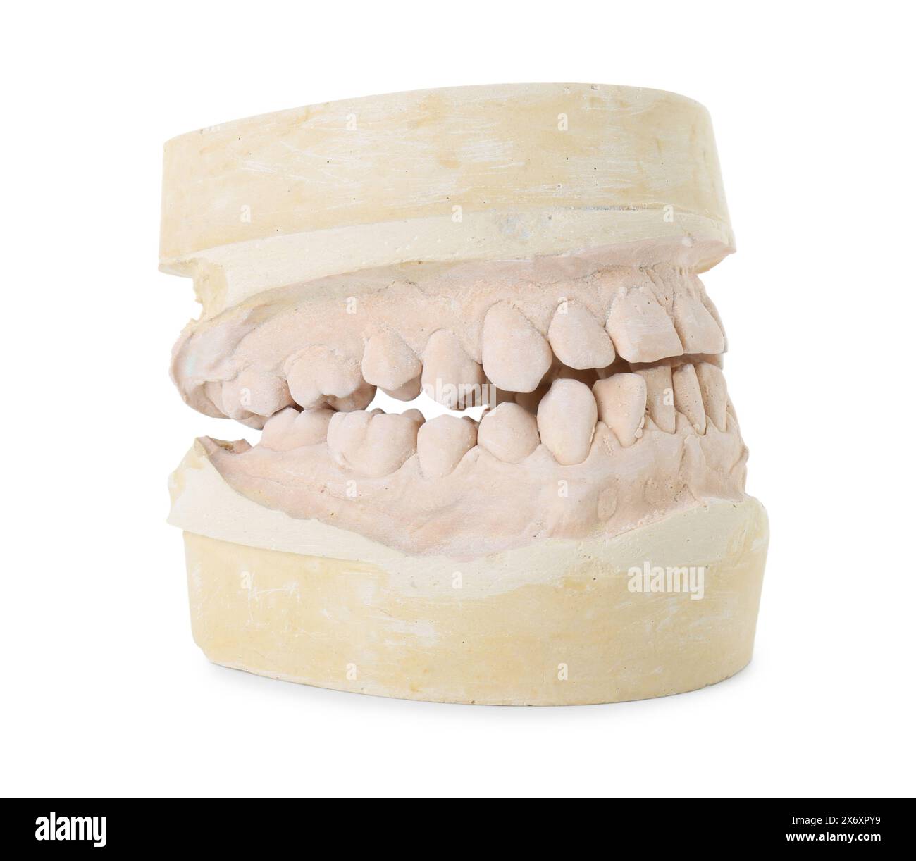 Dental model with jaws isolated on white. Cast of teeth Stock Photo - Alamy