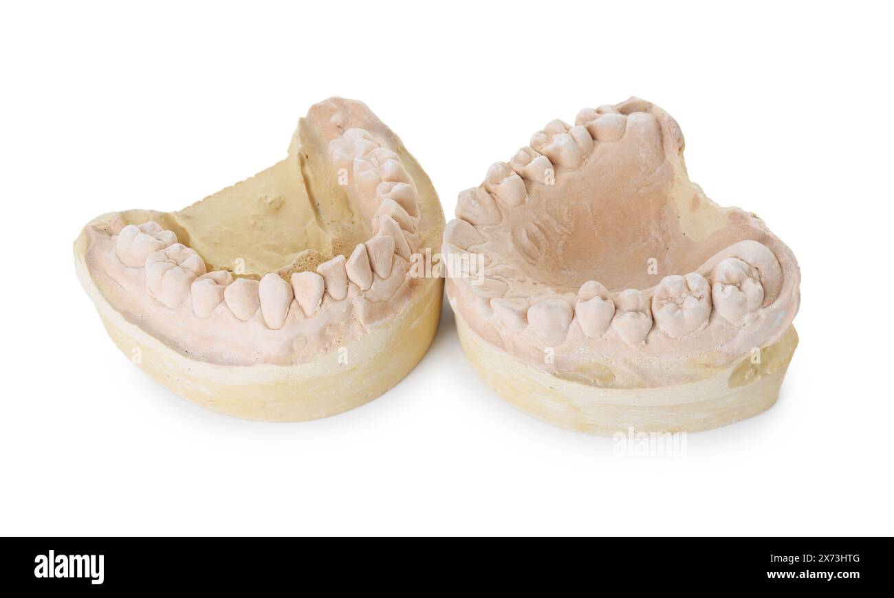 Dental model with jaws isolated on white. Cast of teeth Stock Photo - Alamy