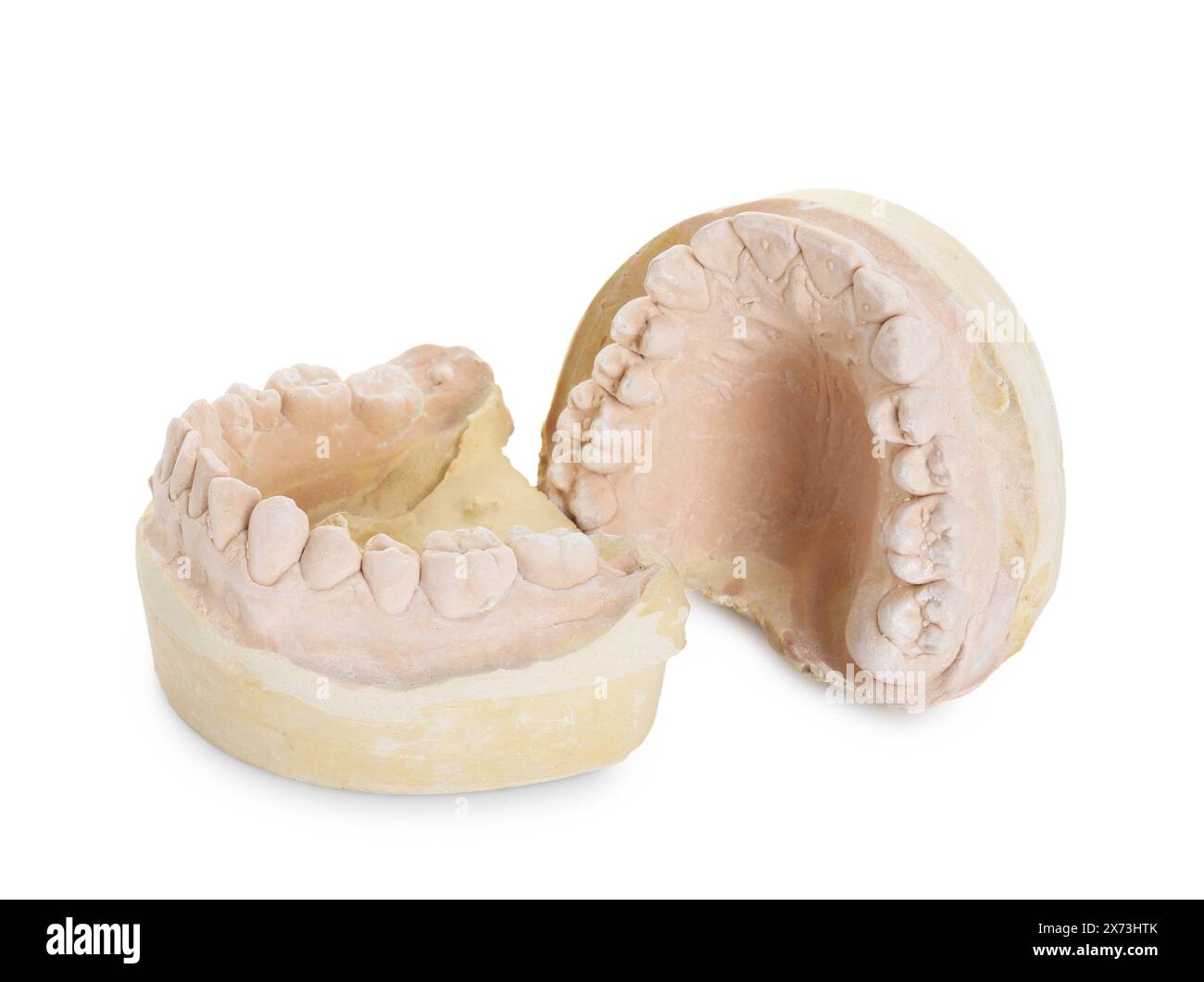 Dental model with jaws isolated on white. Cast of teeth Stock Photo - Alamy