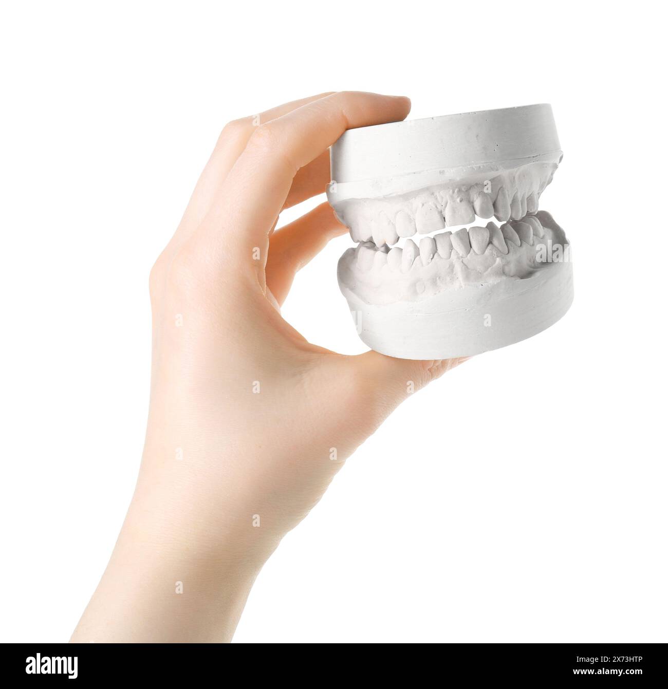 Woman holding dental model with jaws on white background, closeup. Cast ...