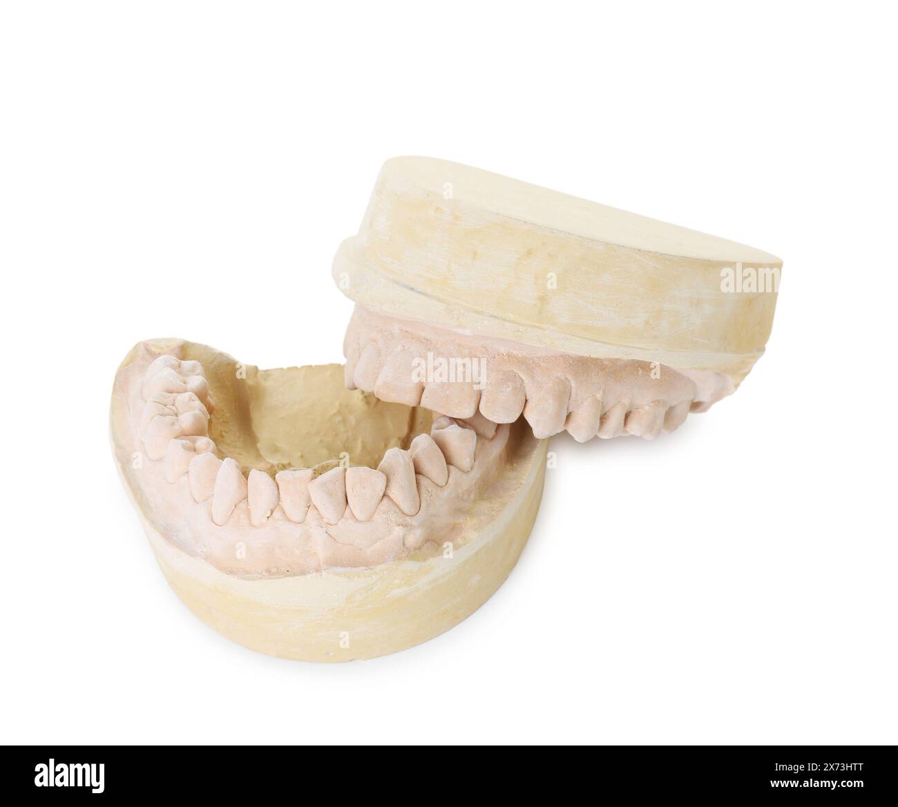 Dental model with jaws isolated on white. Cast of teeth Stock Photo - Alamy