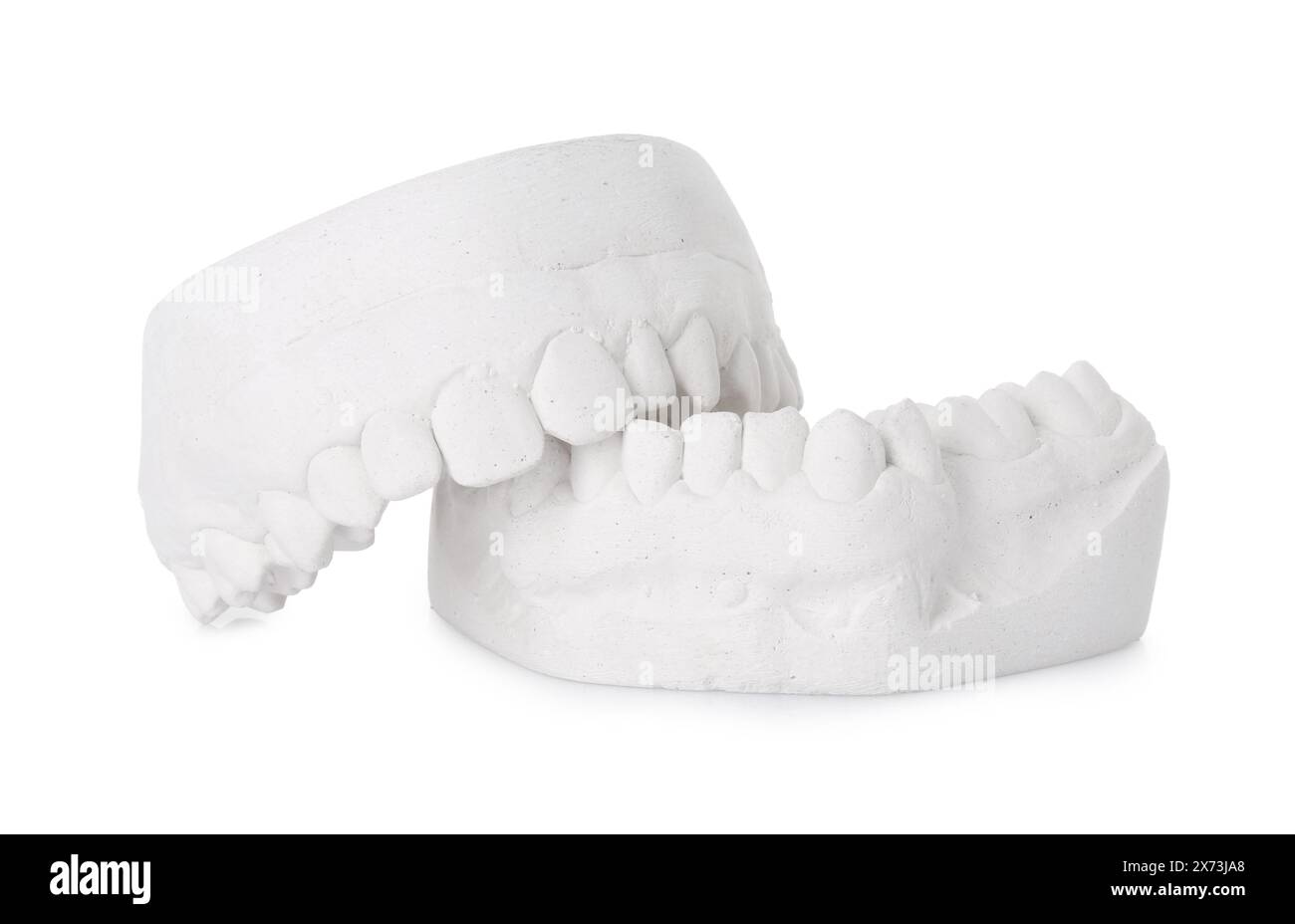 Dental model with gums isolated on white. Cast of teeth Stock Photo - Alamy