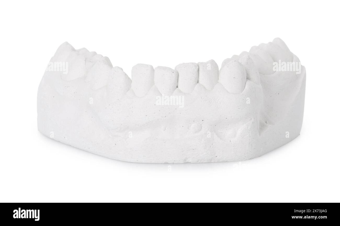 Dental model with gum isolated on white. Cast of teeth Stock Photo - Alamy
