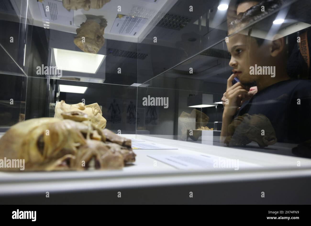 Real bodies exhibition hi-res stock photography and images - Alamy