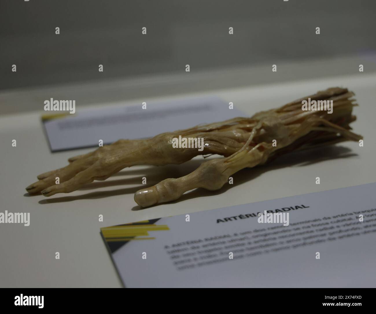 Real human bodies hi-res stock photography and images - Alamy