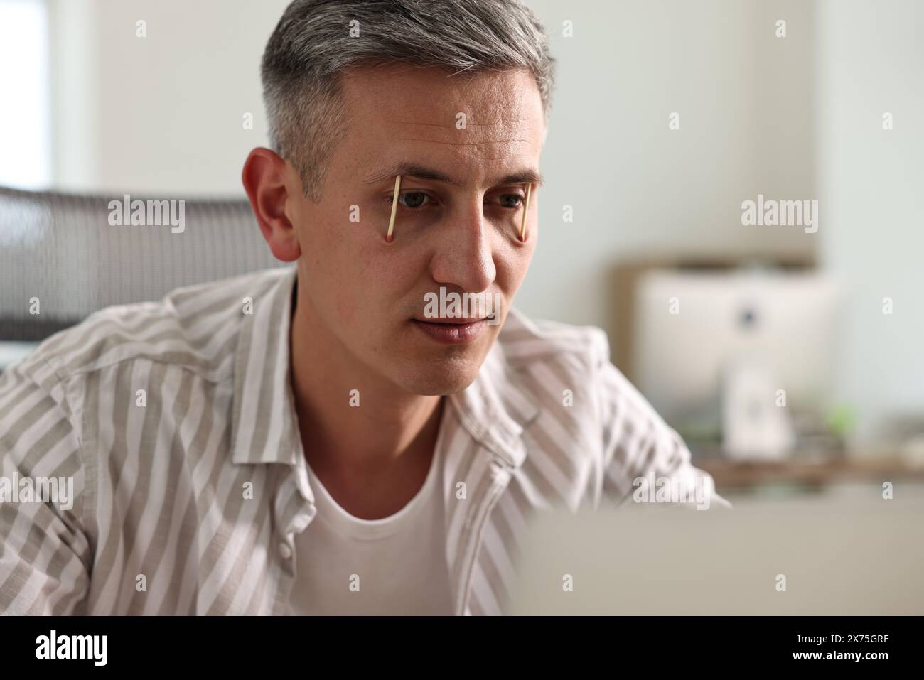 Sleepy man keeping eyes wide open with matches at workplace in office ...